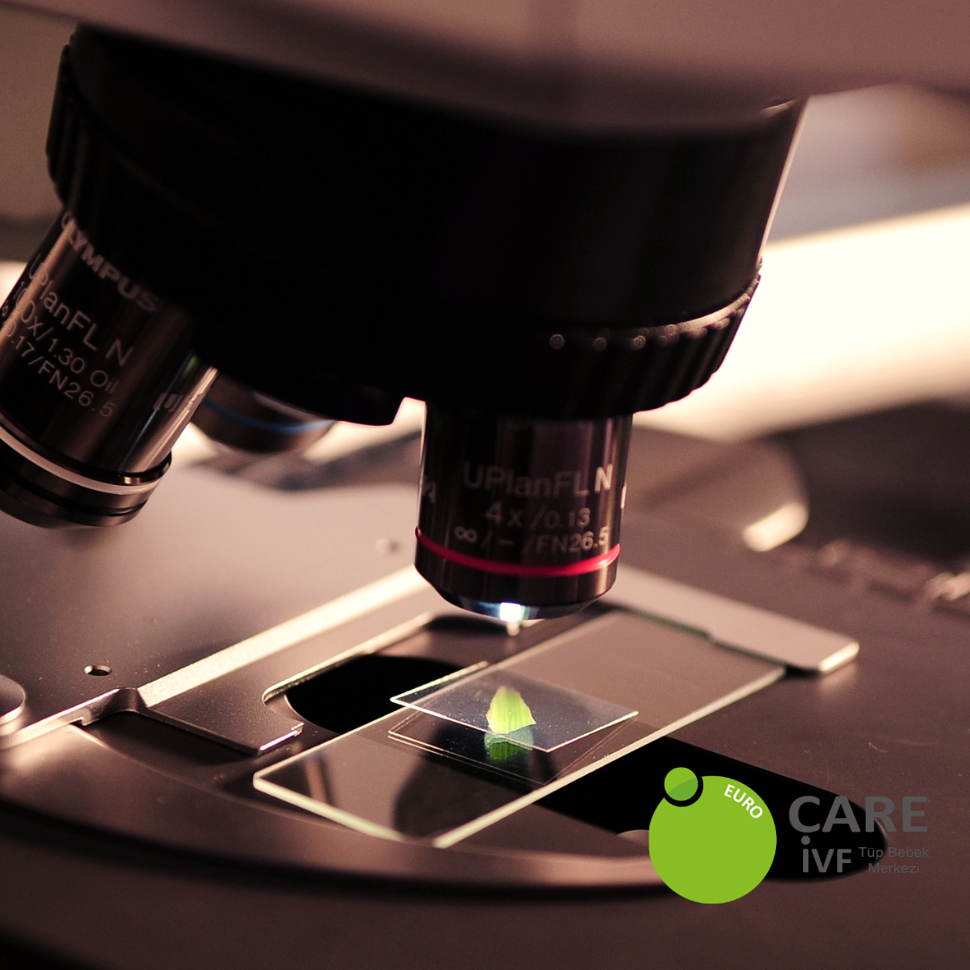 Embryo Grading in IVF & Pregnancy Success | EuroCARE IVF Center